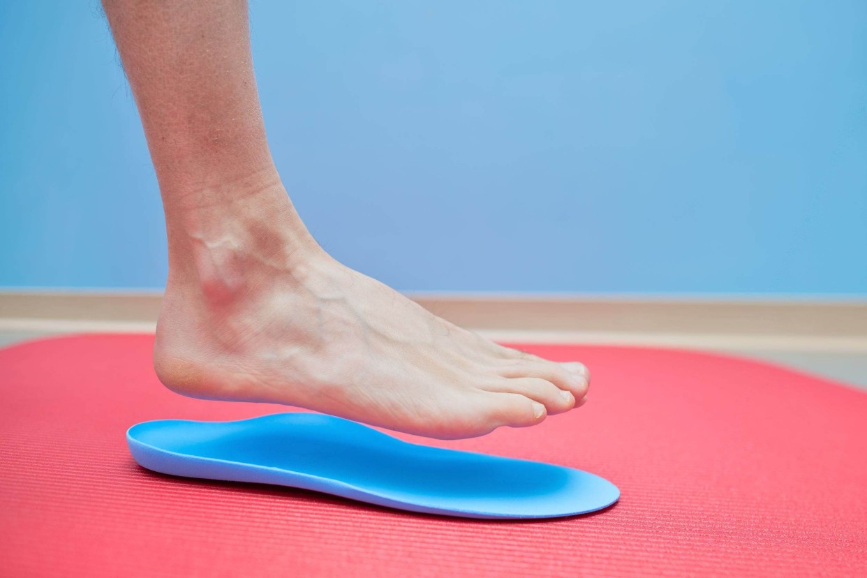 In-Toeing and Out-Toeing: Causes, Symptoms and Treatment | Podiatrist