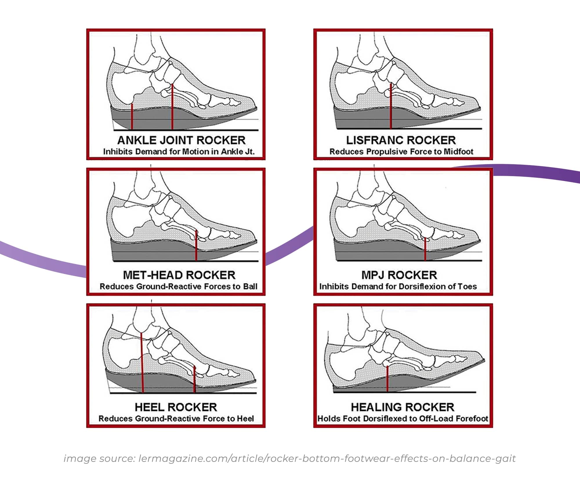 Footwear Modifications | The Feet People Podiatry