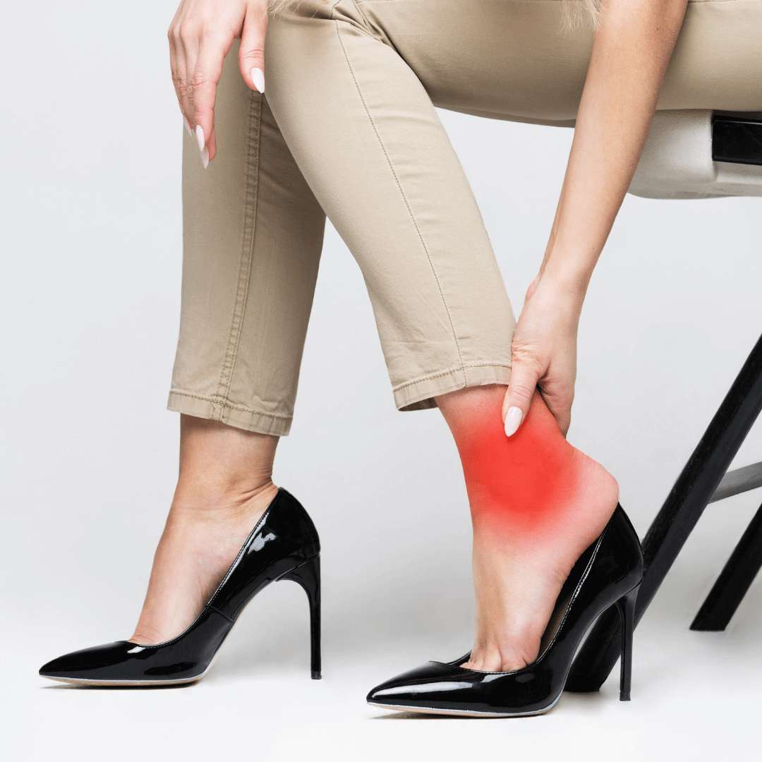 Heel Spurs: Treatment, Causes & Symptoms | The Feet People Podiatry