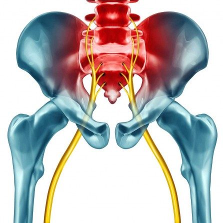 Sciatica: Symptoms, Causes & Treatment | The Feet People Podiatry